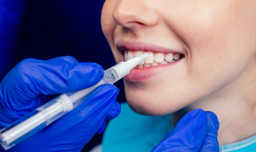 Protect Your Smile from Cavities with Dental Sealants