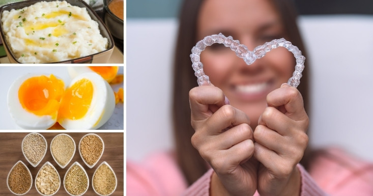 Foods to Eat and Avoid After Invisalign Treatment
